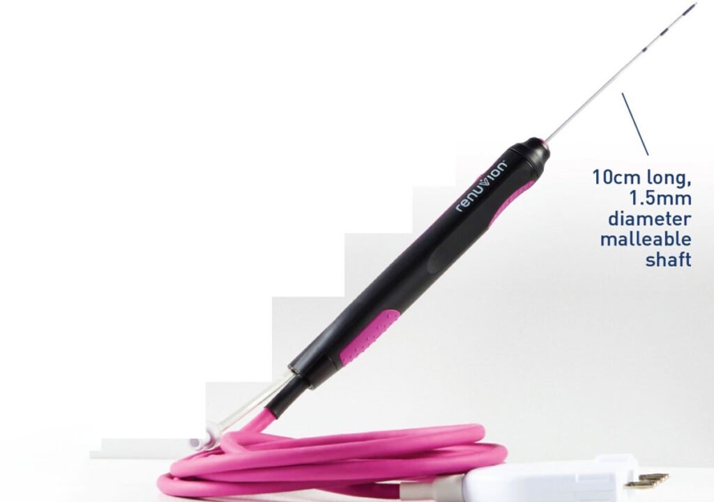 Renuvion Skin Tightening in NYC, NY | MirSkin